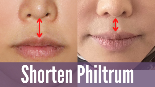 Shorten philtrum | Koko Face Yoga
